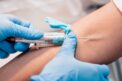What is Phlebotomy, and Why Might You Need It? Miles Pharmacy Explains ...