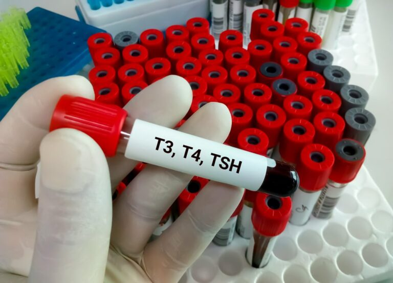 What is T4 Blood Test For? - Miles Pharmacy