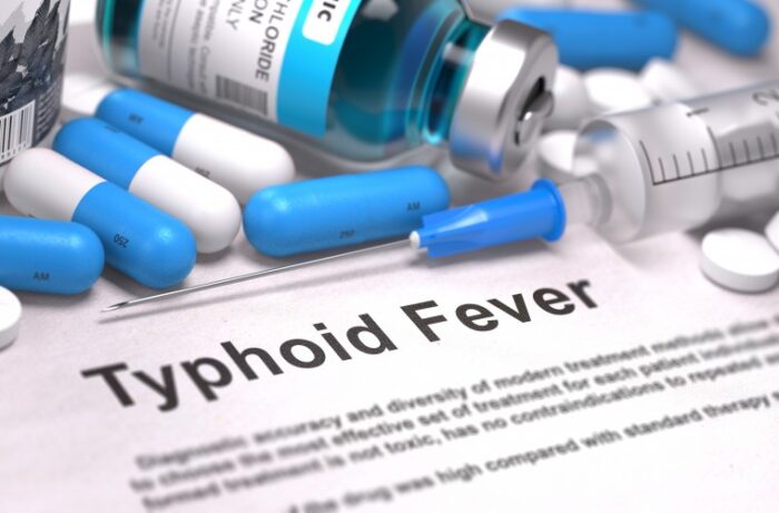 How Typhoid Spreads and How to Protect Yourself? - Miles Pharmacy
